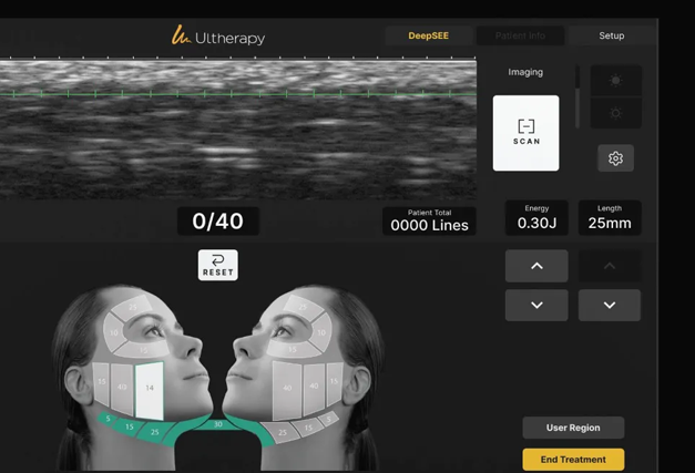 Ultherapy Prime | FreshCodeClinic